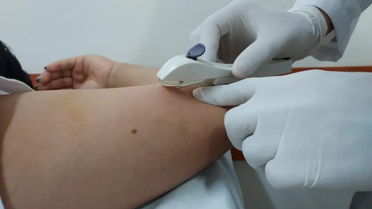 Anticoncepción segura y gratuita. Realiza IMSS Jornada de Colocación de ...